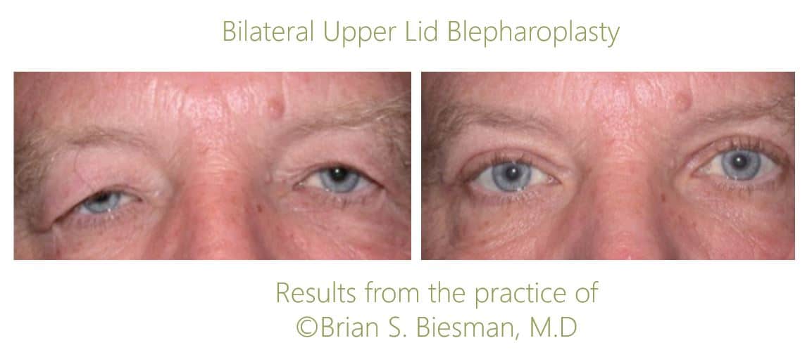 A NEW YEAR AHEAD! - Brian S. Biesman M.D.